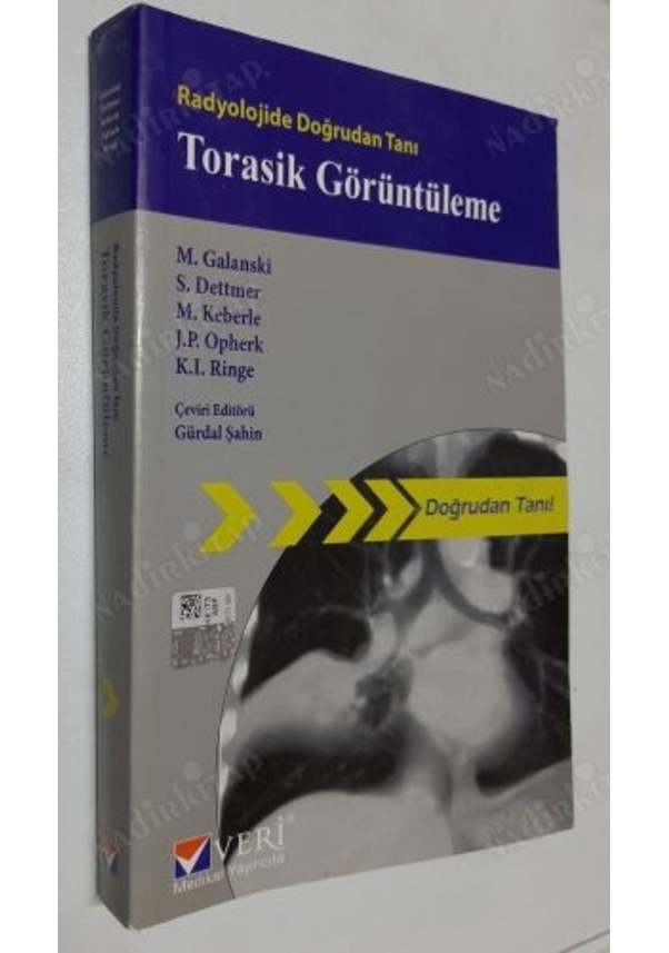Radyolojide Doğrudan Tanı Torasik Görüntüleme Fiyatları ve Özellikleri