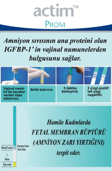 Actim Prom Fetal Membran Yırtığı Testi Fiyatları ve Özellikleri